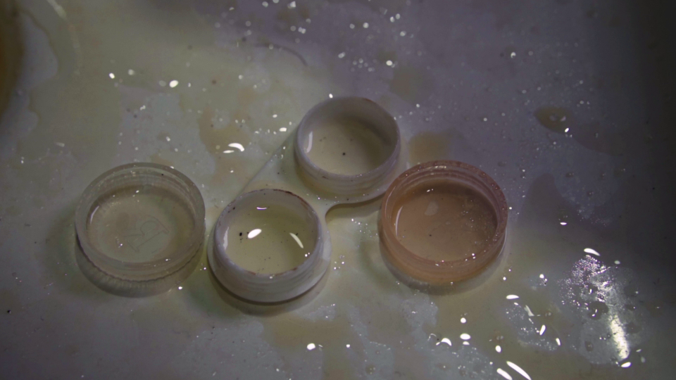 Top 5 Mistakes Contact Lens Wearer Often Make! – Visiokraft Optometrist ...